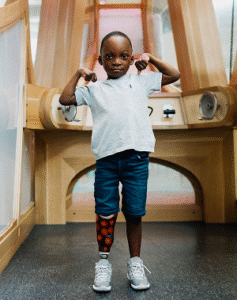 PFAPA Syndrome: Periodic Fever Diagnosis & Care | DCH
